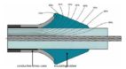 MV Cables | Electric Field & Stress Control | Medium Voltage Joints Cables